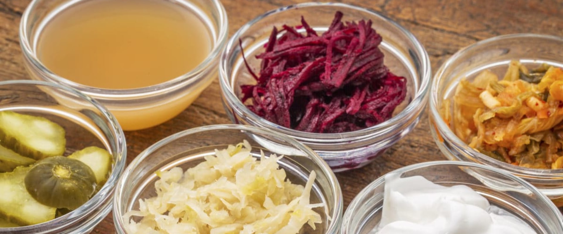 Increase Your Intake of Probiotic-Rich Foods to Prevent Toenail Fungus